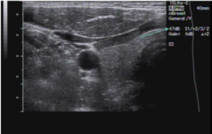 All the Knowledge You Need About Ultrasound Applications and Image ...