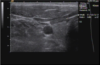 All the Knowledge You Need About Ultrasound Applications and Image ...