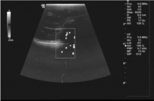 All the Knowledge You Need About Ultrasound Applications and Image ...