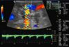 Noise artifacts in diagnostic ultrasound - Innovatus Imaging