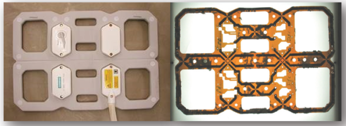 Common MRI Coil Failures - Innovatus Imaging